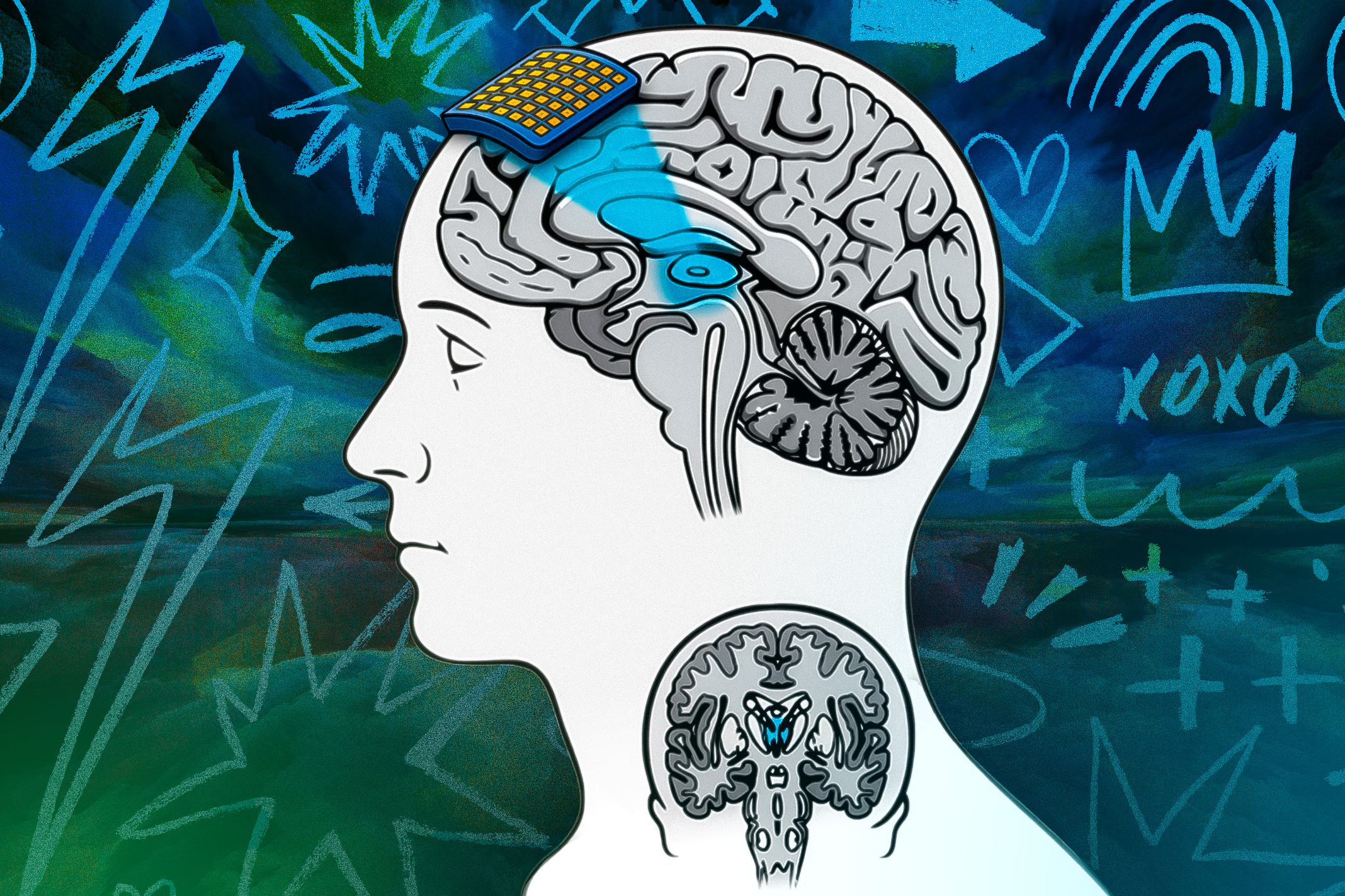 This new tool could tell us how consciousness works - MIT School of ...